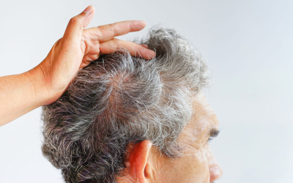 The 7 Best Scalp Moisturizers for Oily Haired Men
